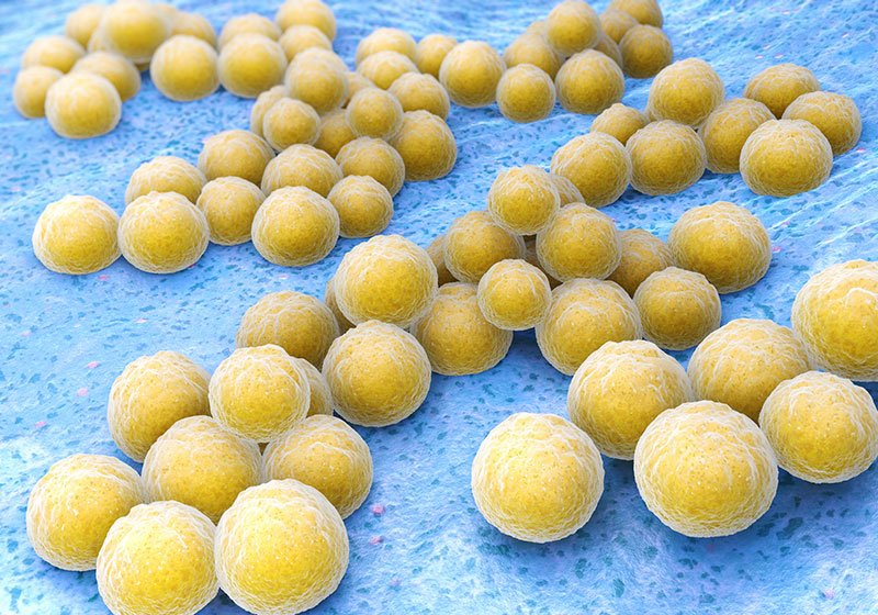 Virulence Meets Metabolism: The Unique Evolution of Staphylococcus aureus